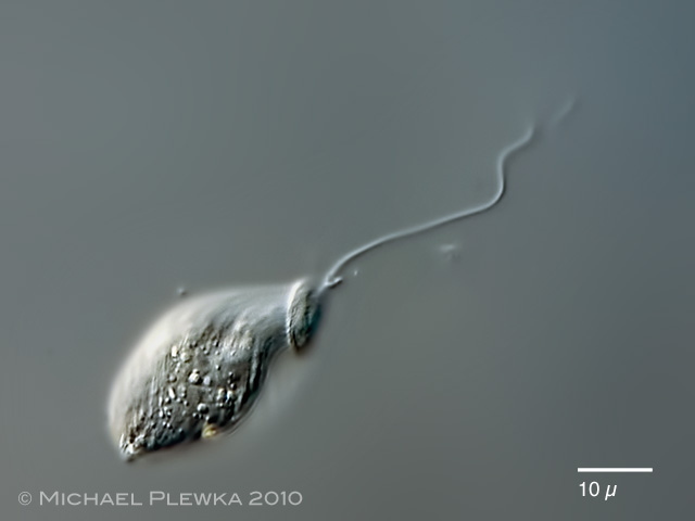 Freshwater and other micro-organisms from Germany: Urceolus cyclostomus (STEIN) MERESCHK ...